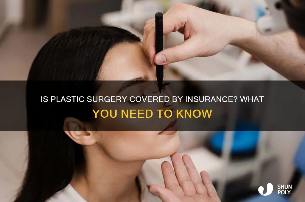 Is Plastic Surgery Covered By Insurance? What You Need To Know | ShunPoly