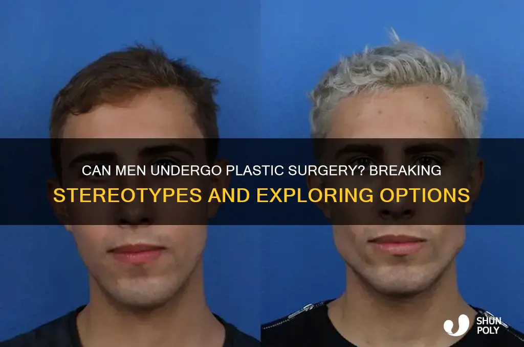 Can Men Undergo Plastic Surgery? Breaking Stereotypes And Exploring ...