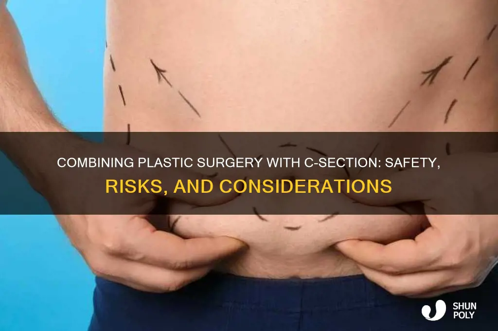 Combining Plastic Surgery With C-Section: Safety, Risks, And ...