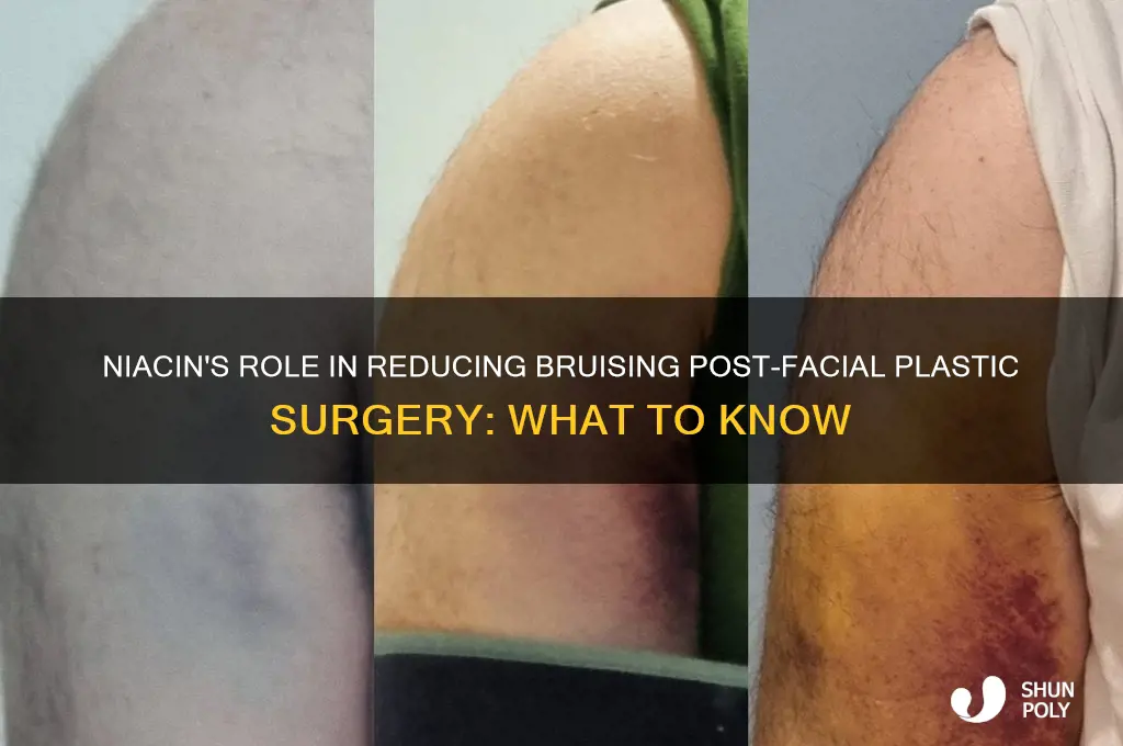 Niacin's Role In Reducing Bruising Post-Facial Plastic Surgery: What To ...