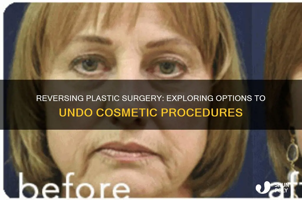 Reversing Plastic Surgery: Exploring Options To Undo Cosmetic ...