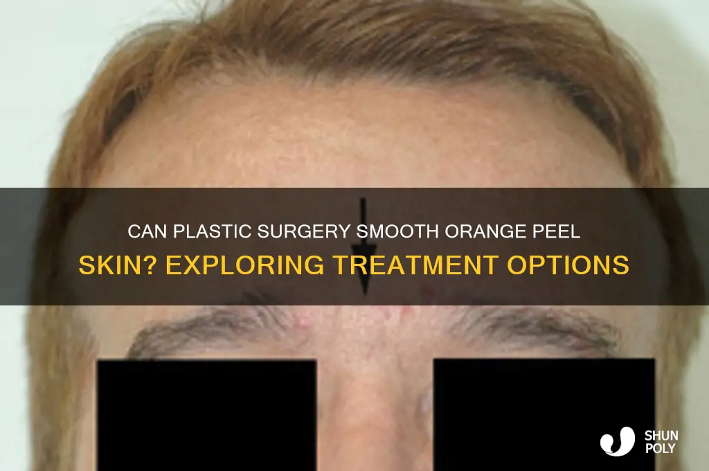 Can Plastic Surgery Smooth Orange Peel Skin? Exploring Treatment ...
