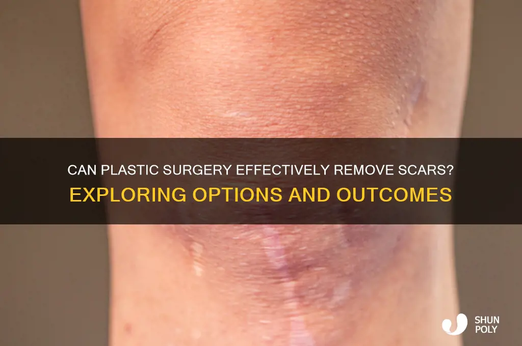 Can Plastic Surgery Effectively Remove Scars? Exploring Options And ...