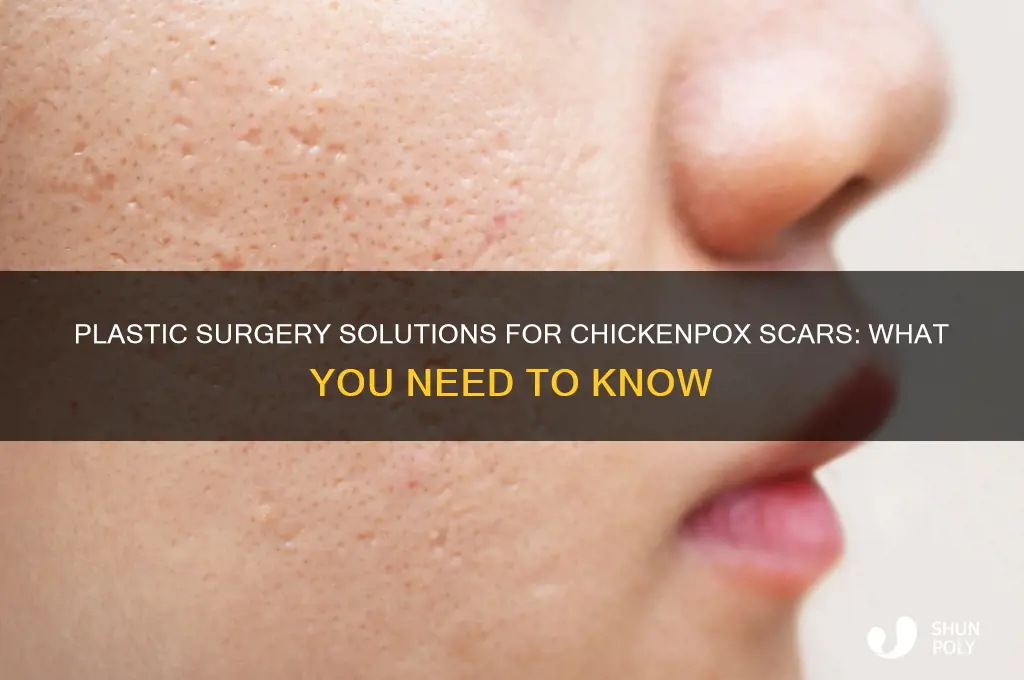 Plastic Surgery Solutions For Chickenpox Scars: What You Need To Know ...