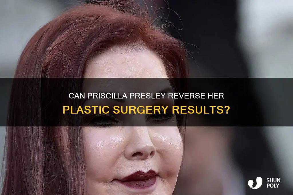 Can Priscilla Presley Reverse Her Plastic Surgery Results? | ShunPoly
