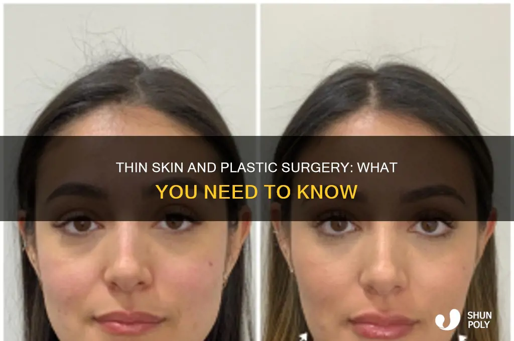 Thin Skin And Plastic Surgery: What You Need To Know | ShunPoly