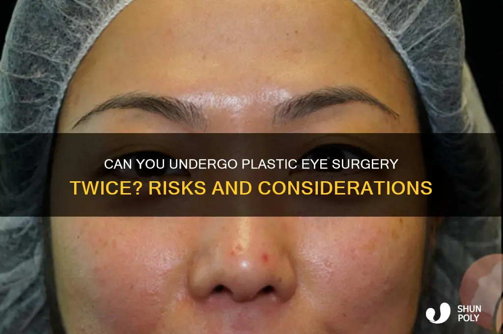 Can You Undergo Plastic Eye Surgery Twice? Risks And Considerations ...