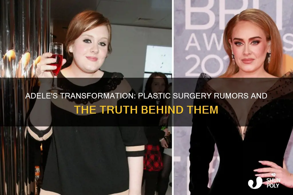 Adele's Transformation: Plastic Surgery Rumors And The Truth Behind ...