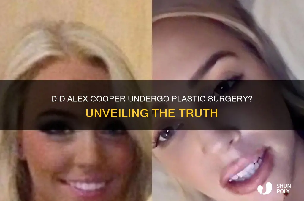 Did Alex Cooper Undergo Plastic Surgery? Unveiling The Truth | ShunPoly