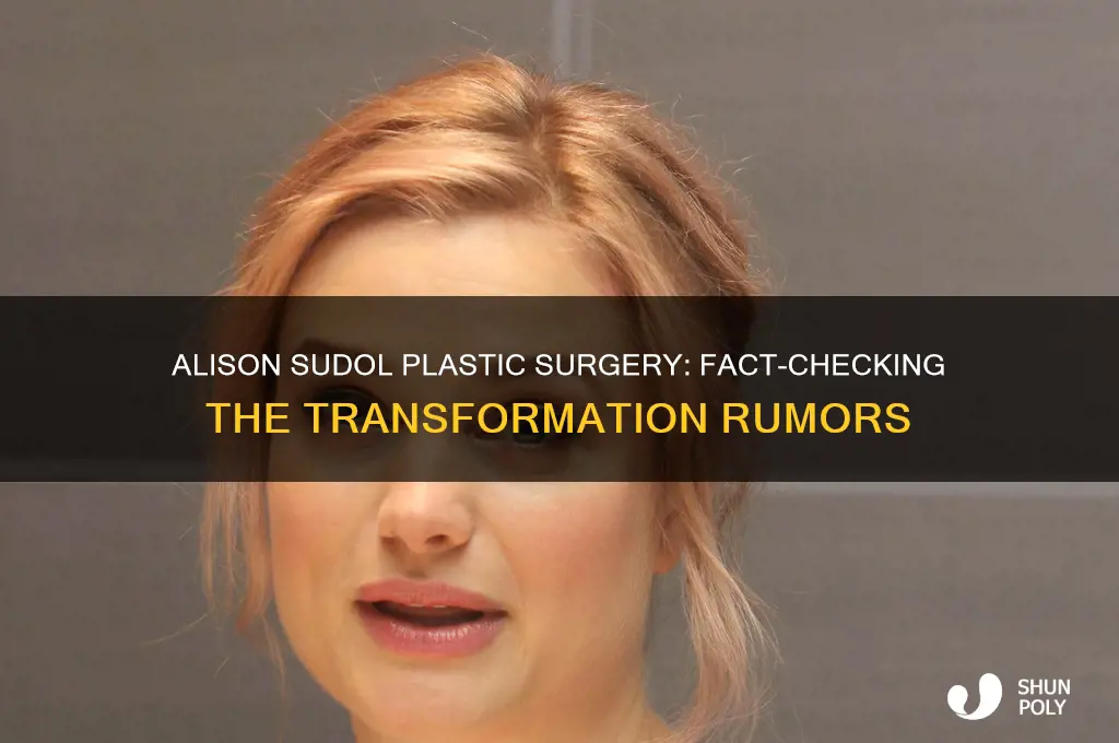 Alison Sudol Plastic Surgery: Fact-Checking The Transformation Rumors ...