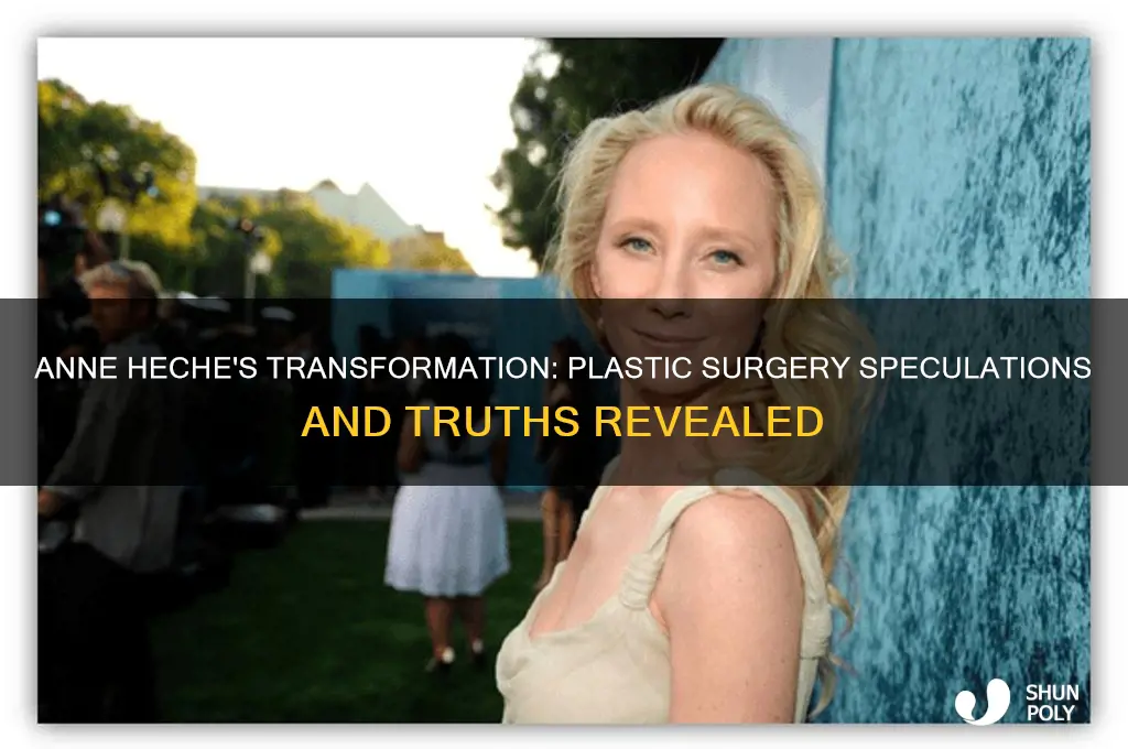 Anne Heche's Transformation: Plastic Surgery Speculations And Truths ...