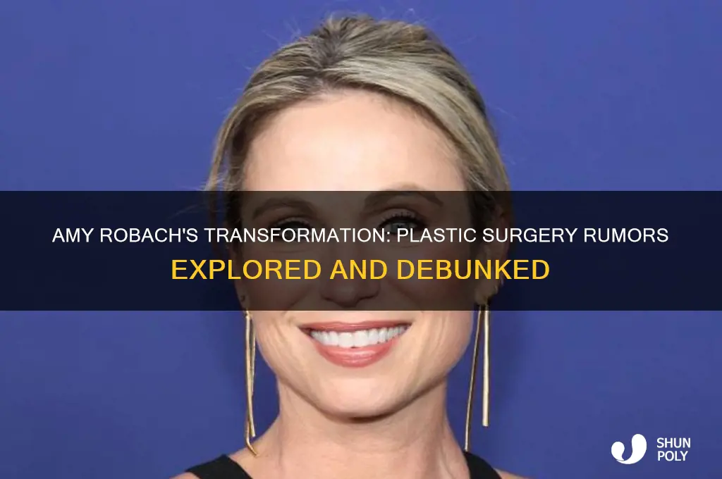 Amy Robach's Transformation: Plastic Surgery Rumors Explored And ...