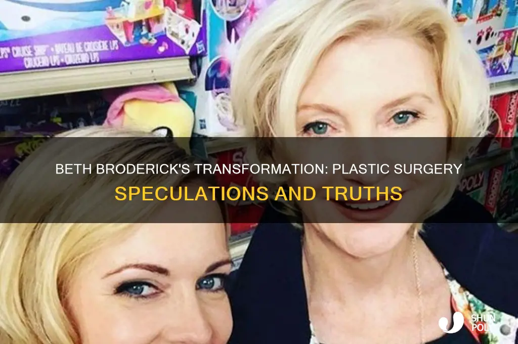 Beth Broderick's Transformation: Plastic Surgery Speculations And ...