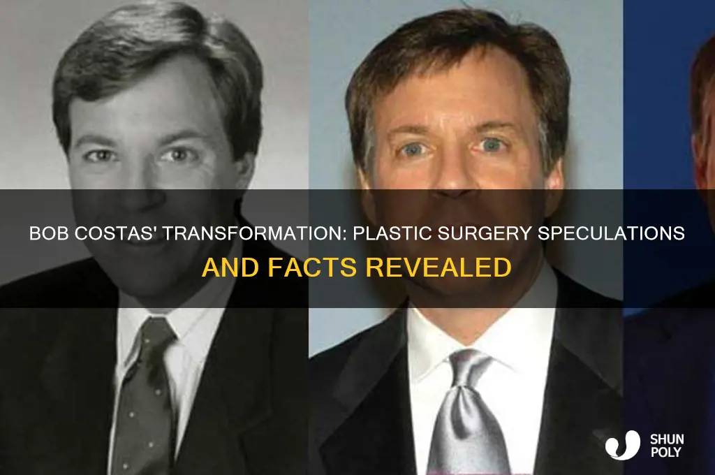 Bob Costas' Transformation: Plastic Surgery Speculations And Facts ...