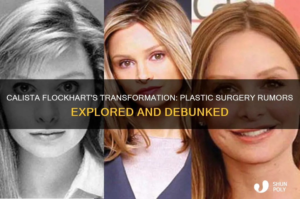 Calista Flockhart's Transformation: Plastic Surgery Rumors Explored And ...