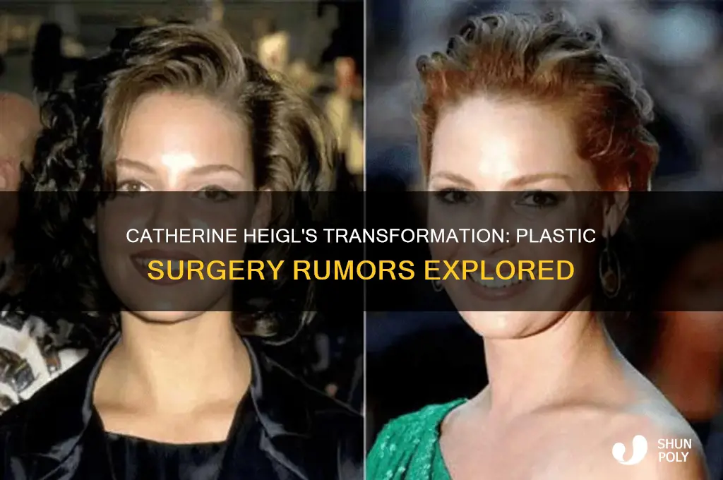 Catherine Heigl's Transformation: Plastic Surgery Rumors Explored ...