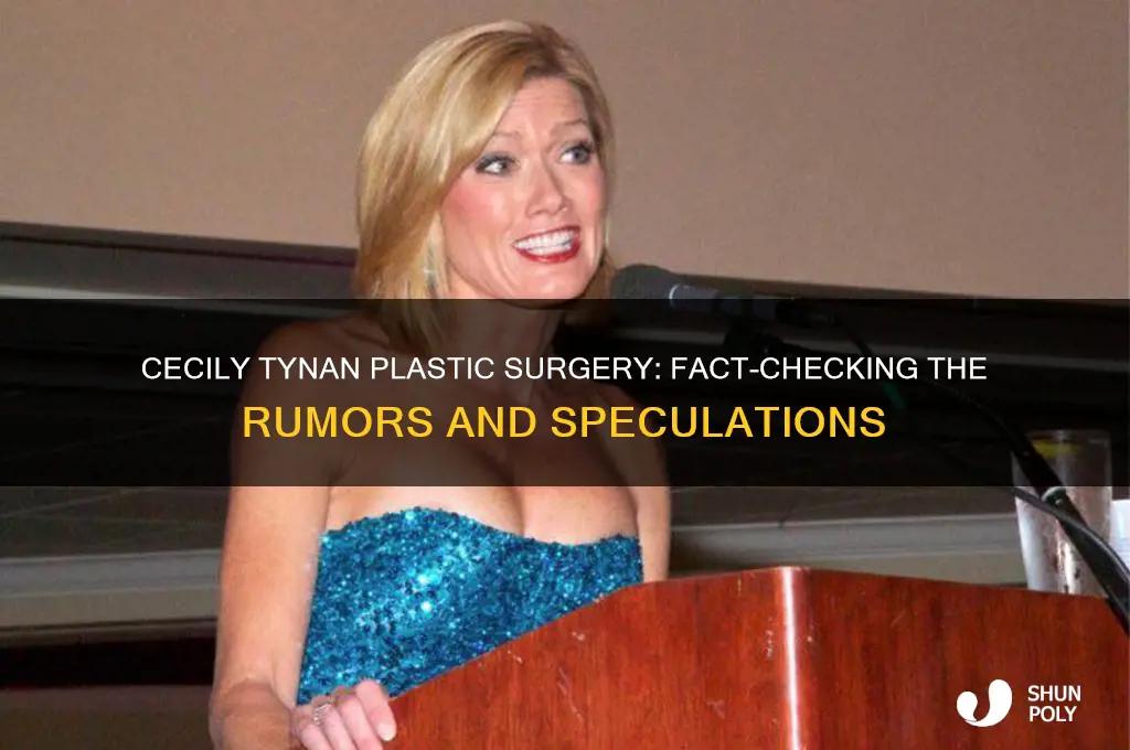 Cecily Tynan Plastic Surgery: Fact-Checking The Rumors And Speculations ...