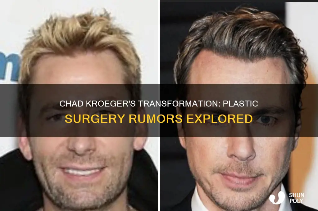 Chad Kroeger's Transformation: Plastic Surgery Rumors Explored | ShunPoly