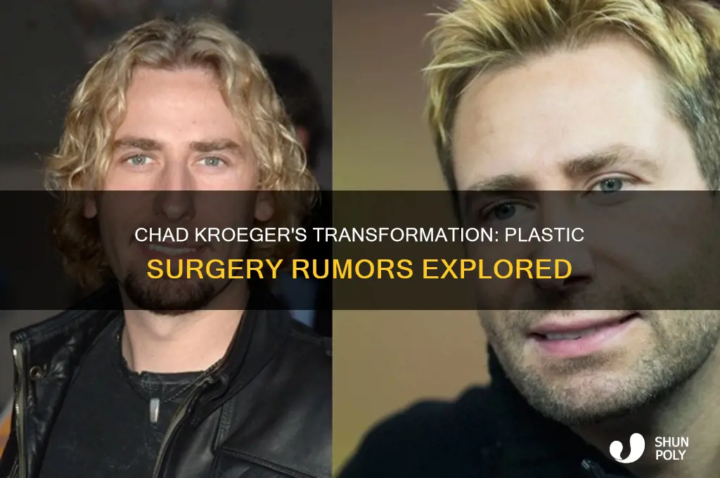 Chad Kroeger's Transformation: Plastic Surgery Rumors Explored | ShunPoly