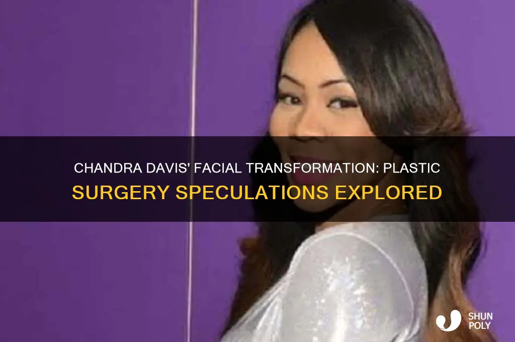 Chandra Davis' Facial Transformation: Plastic Surgery Speculations ...