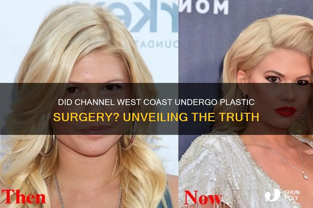 Did Channel West Coast Undergo Plastic Surgery? Unveiling The Truth ...