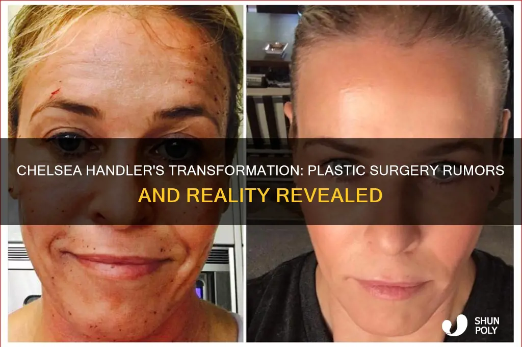 Chelsea Handler's Transformation: Plastic Surgery Rumors And Reality ...