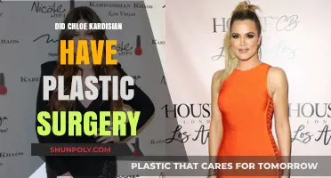 Chloe On Days: Plastic Surgery Speculations And Transformation Truths ...