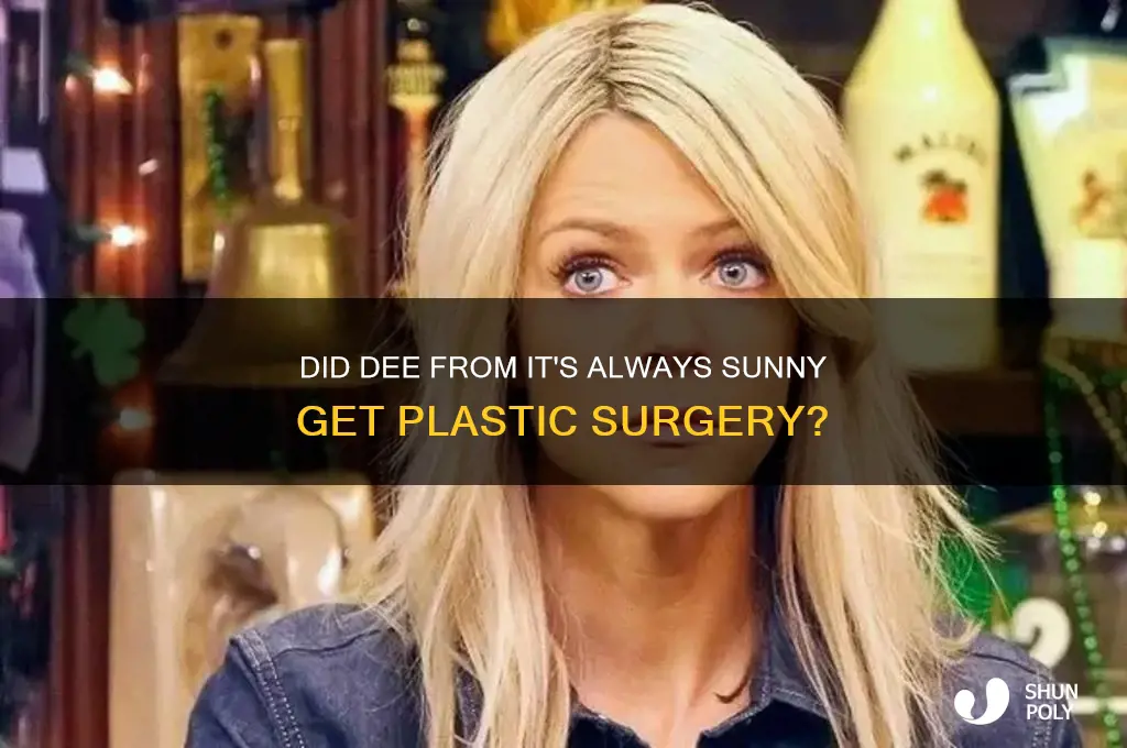 Did Dee From It's Always Sunny Get Plastic Surgery? | ShunPoly