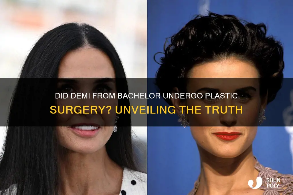 Did Demi From Bachelor Undergo Plastic Surgery? Unveiling The Truth ...