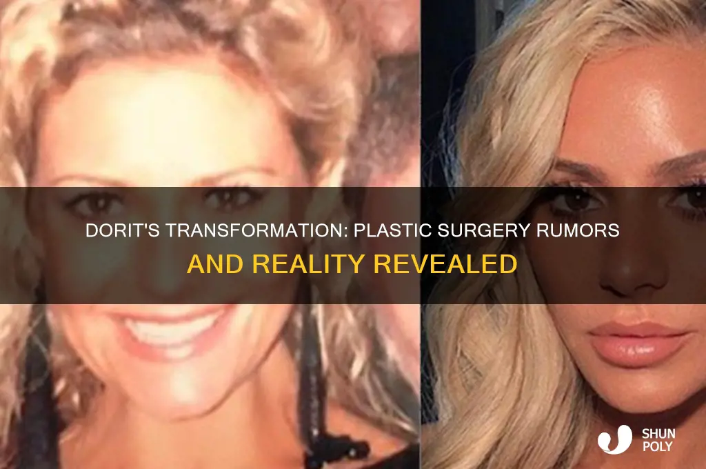 Dorit's Transformation: Plastic Surgery Rumors And Reality Revealed ...