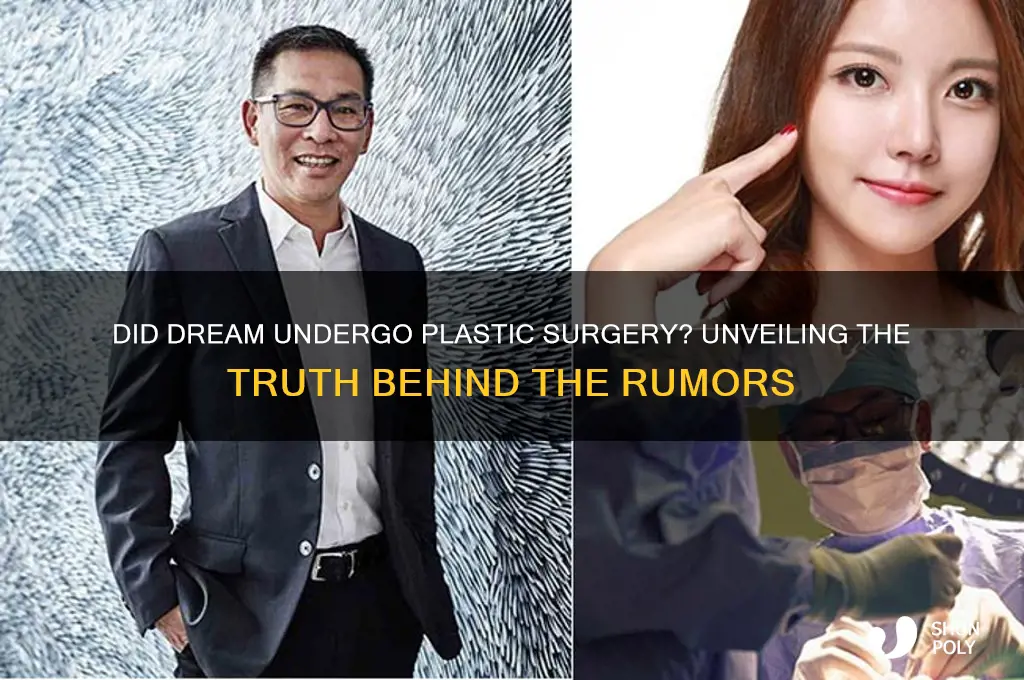 Did Dream Undergo Plastic Surgery? Unveiling The Truth Behind The ...