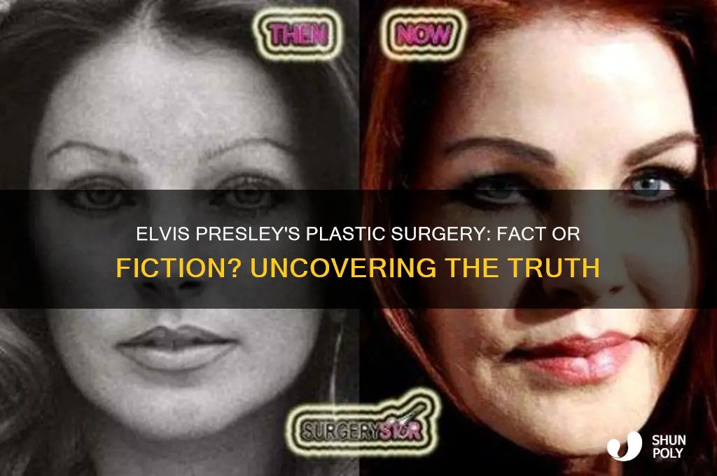 Elvis Presley's Plastic Surgery: Fact Or Fiction? Uncovering The Truth ...
