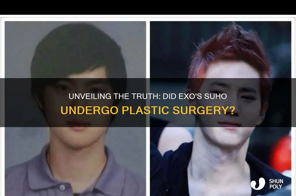Unveiling The Truth: Did Exo's Suho Undergo Plastic Surgery? | ShunPoly