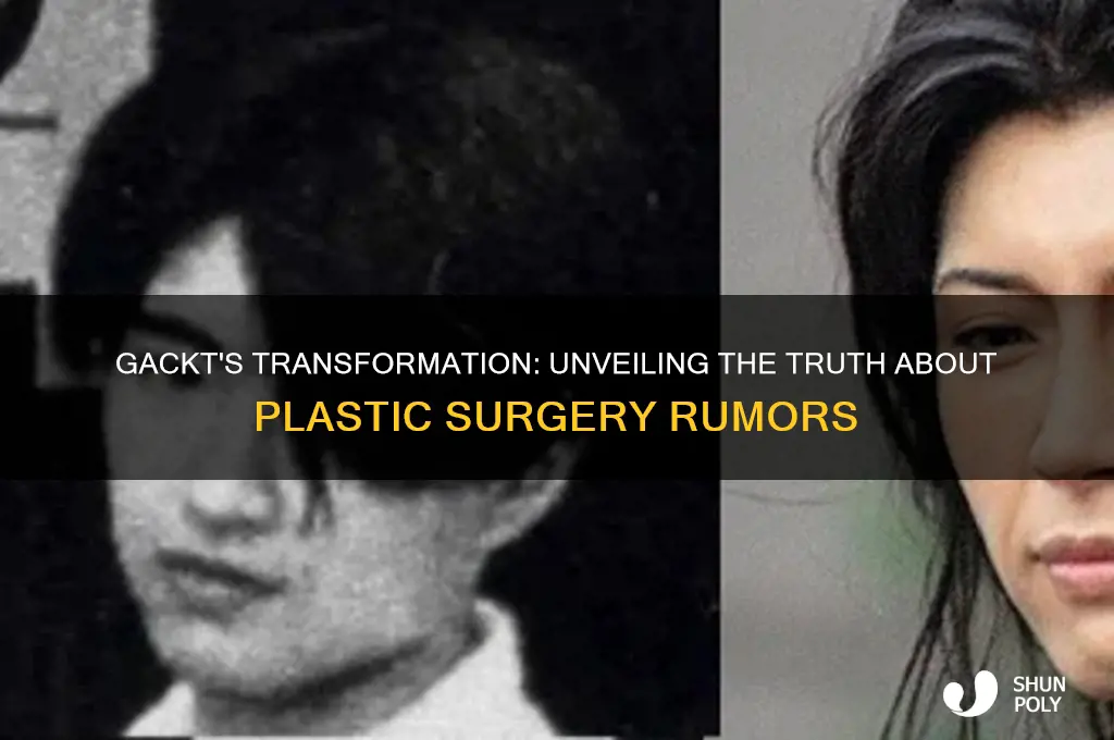 Gackt's Transformation: Unveiling The Truth About Plastic Surgery ...