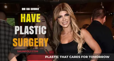 Gillian's Transformation: Plastic Surgery Speculations And The Truth ...