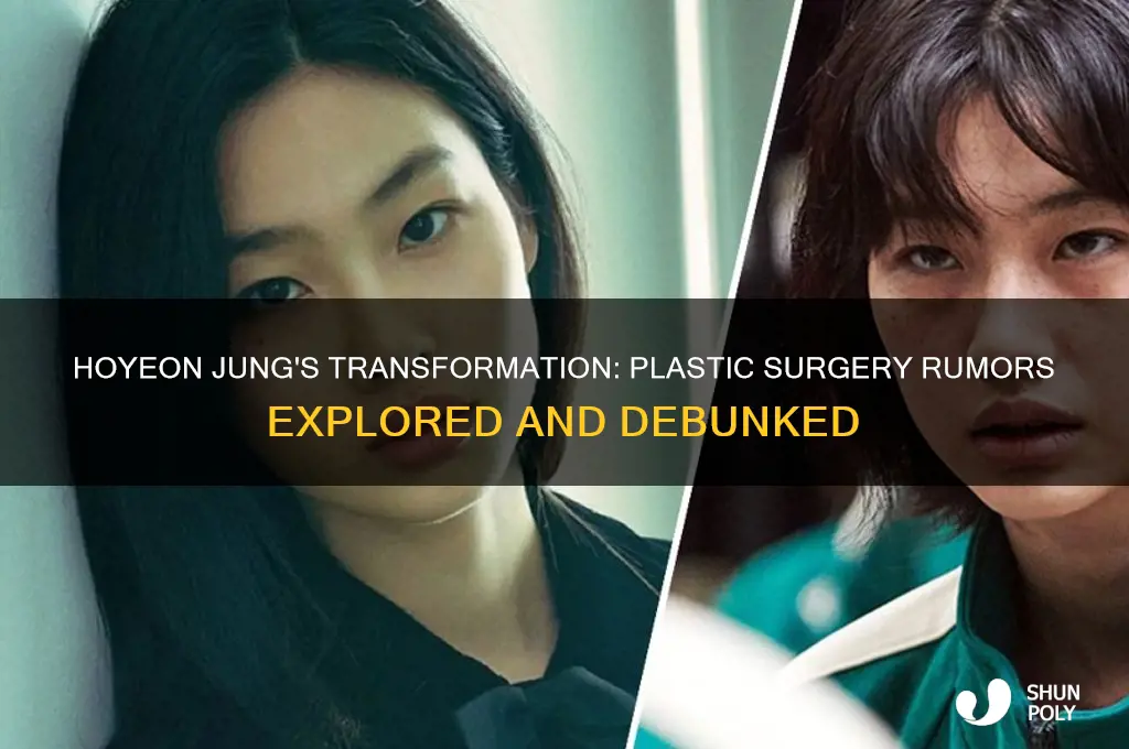 Hoyeon Jung's Transformation: Plastic Surgery Rumors Explored And ...