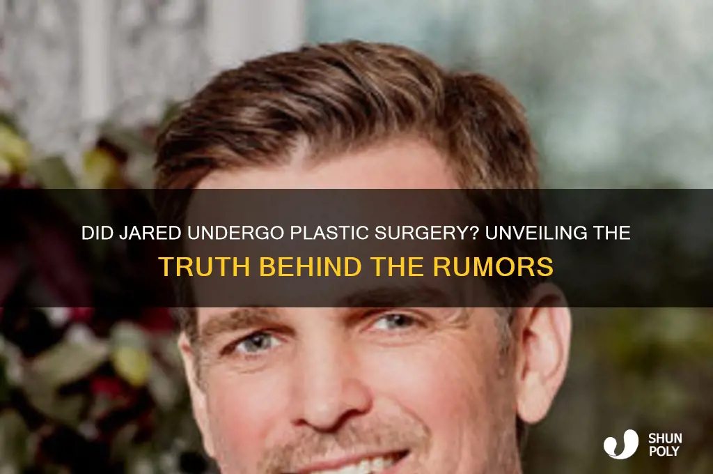 Did Jared Undergo Plastic Surgery? Unveiling The Truth Behind The ...
