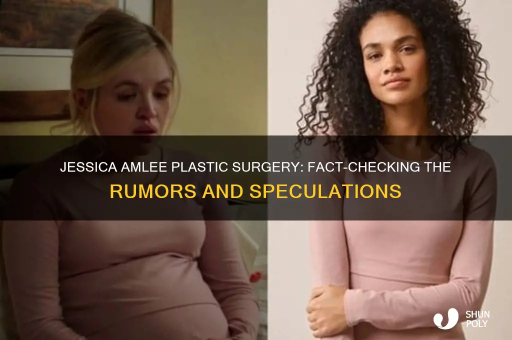 Jessica Amlee Plastic Surgery: Fact-Checking The Rumors And ...