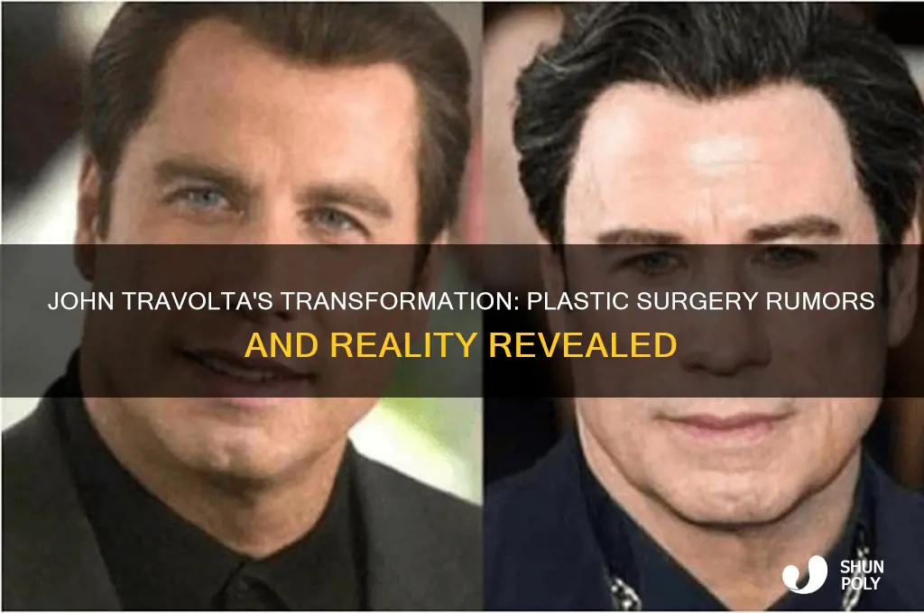 John Travolta's Transformation: Plastic Surgery Rumors And Reality ...