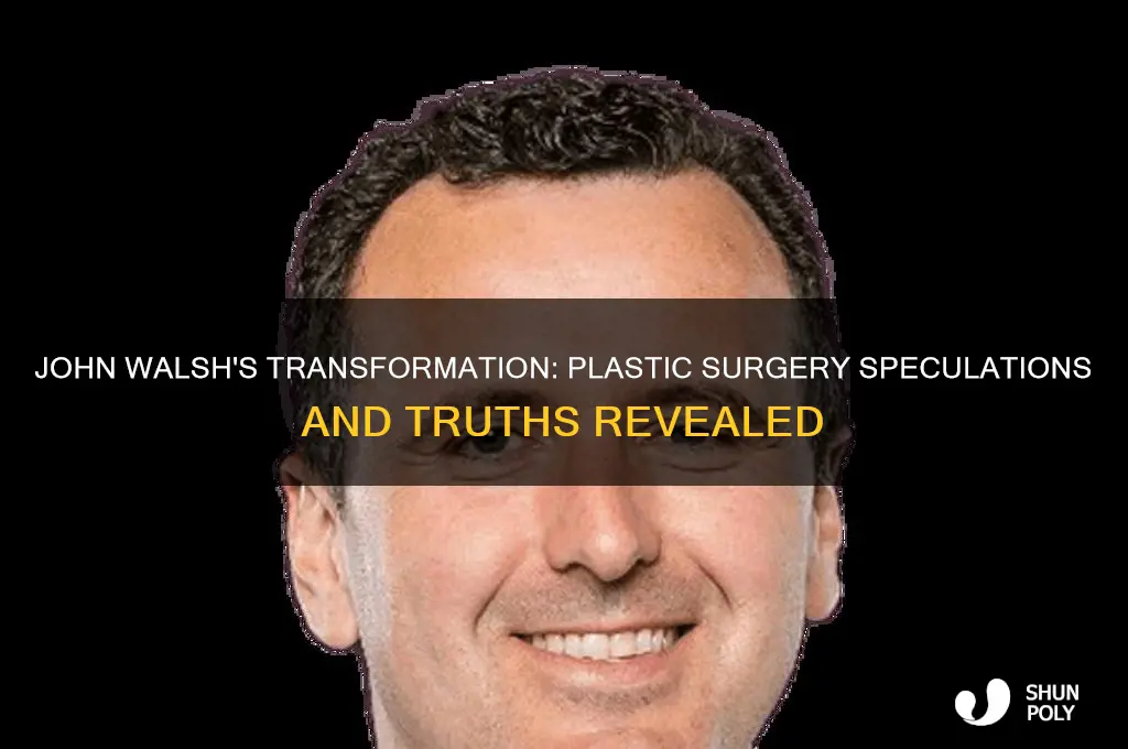 John Walsh's Transformation: Plastic Surgery Speculations And Truths ...