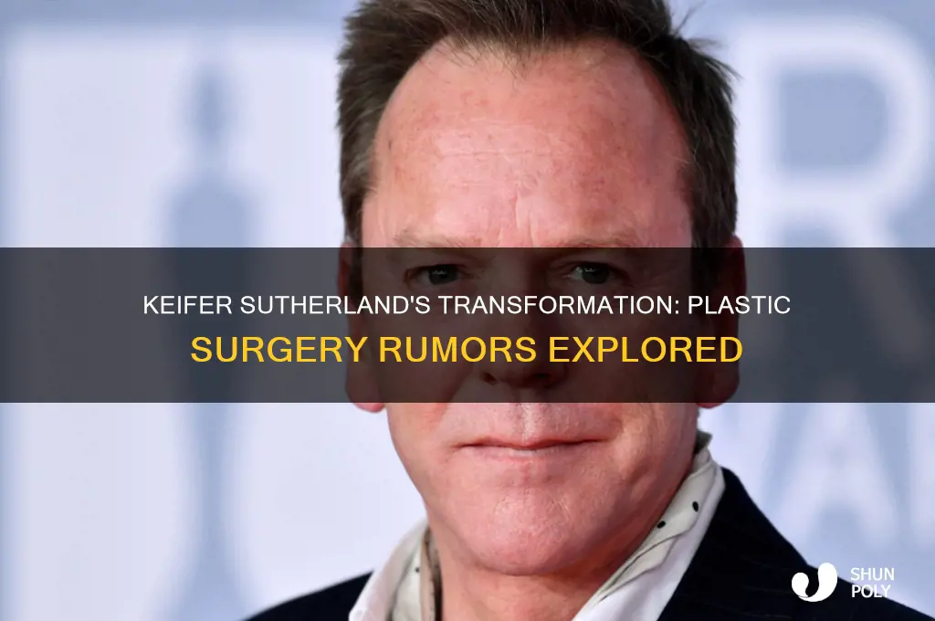 Keifer Sutherland's Transformation: Plastic Surgery Rumors Explored ...