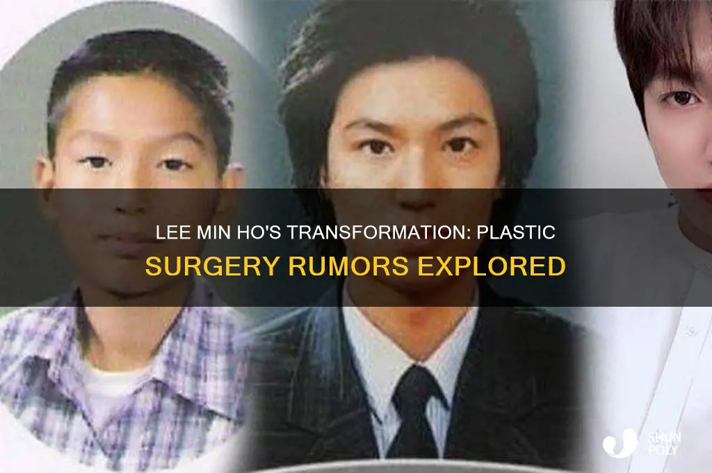 Lee Min Ho's Transformation: Plastic Surgery Rumors Explored | ShunPoly