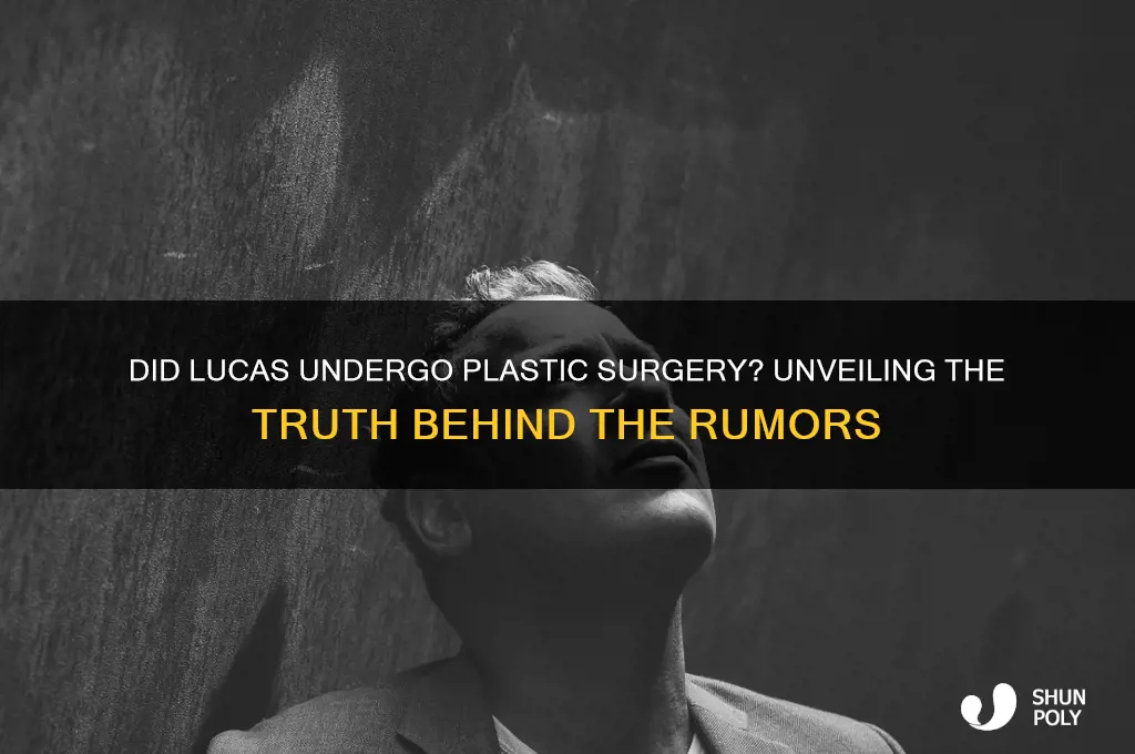 Did Lucas Undergo Plastic Surgery? Unveiling The Truth Behind The ...