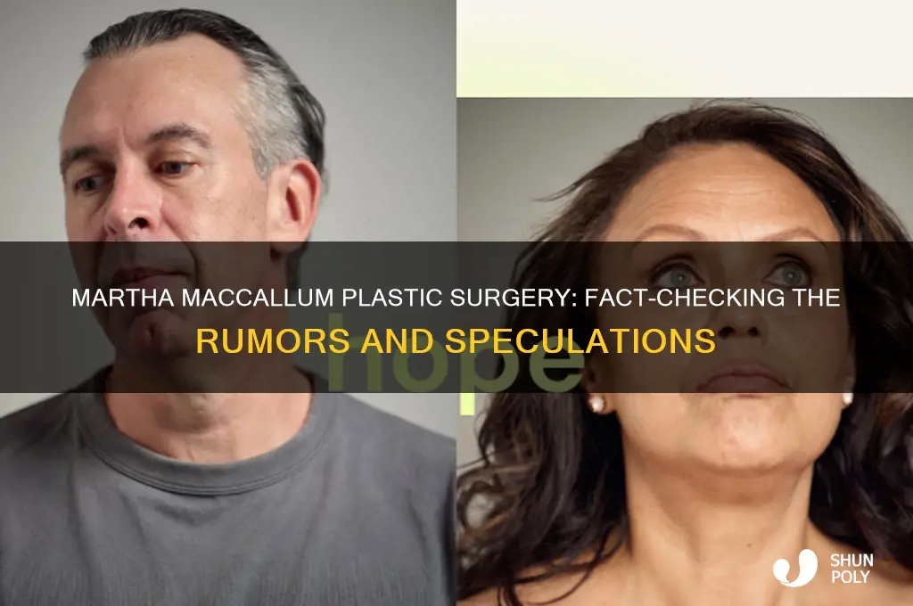 Martha Maccallum Plastic Surgery: Fact-Checking The Rumors And ...
