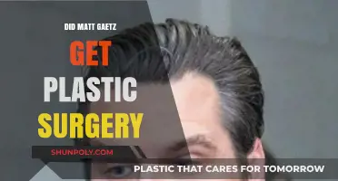 Dana Loesch Plastic Surgery: Fact-Checking The Transformation Rumors ...