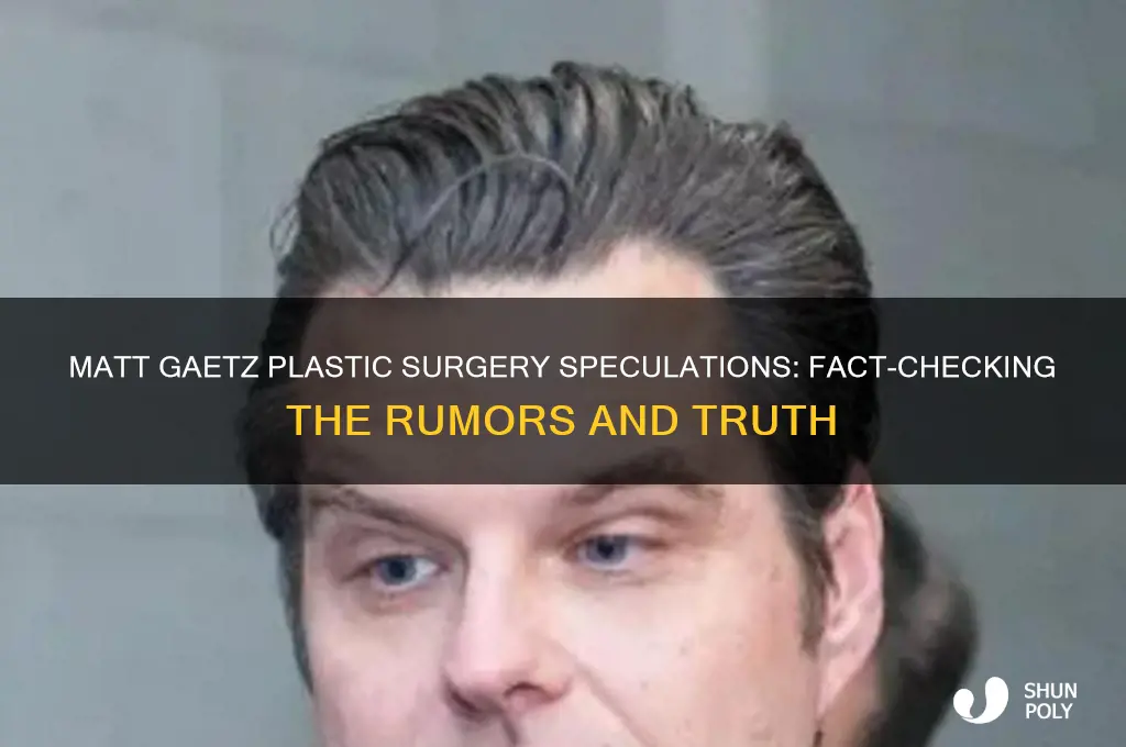 Matt Gaetz Plastic Surgery Speculations: Fact-Checking The Rumors And ...