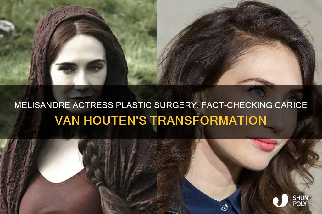 Melisandre Actress Plastic Surgery: Fact-Checking Carice Van Houten's ...