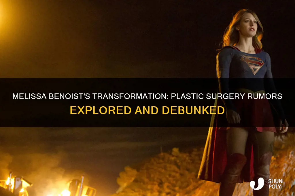 Melissa Benoist's Transformation: Plastic Surgery Rumors Explored And ...