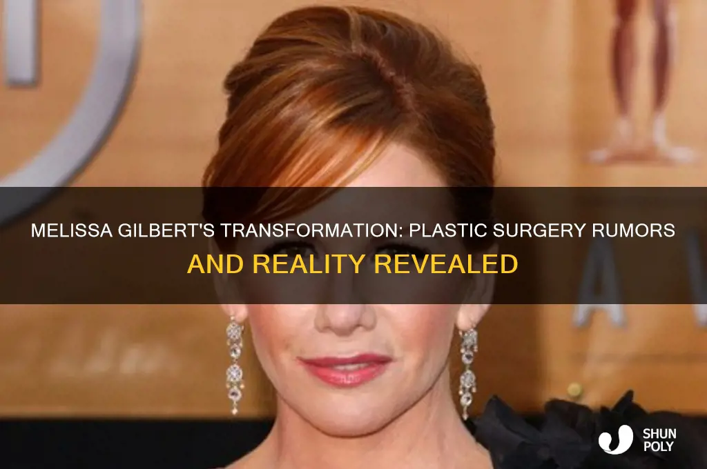 Melissa Gilbert's Transformation: Plastic Surgery Rumors And Reality ...