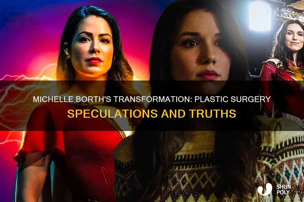 Michelle Borth's Transformation: Plastic Surgery Speculations And ...